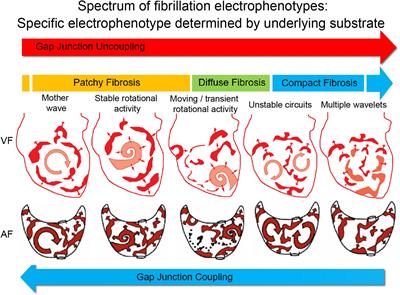 Frontiers | Toward Mechanism-Directed Electrophenotype-Based Treatments for Atrial Fibrillation